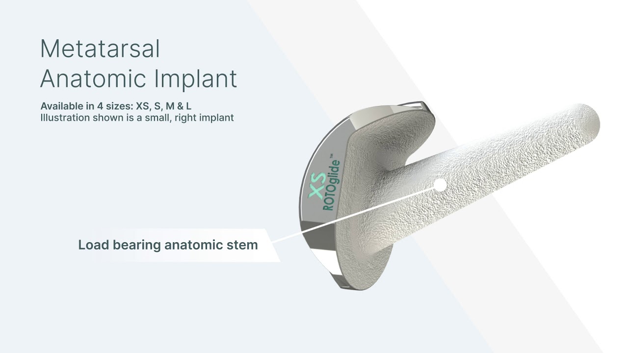 RotoGlide Anatomic Metatarsal Implant - YouTube