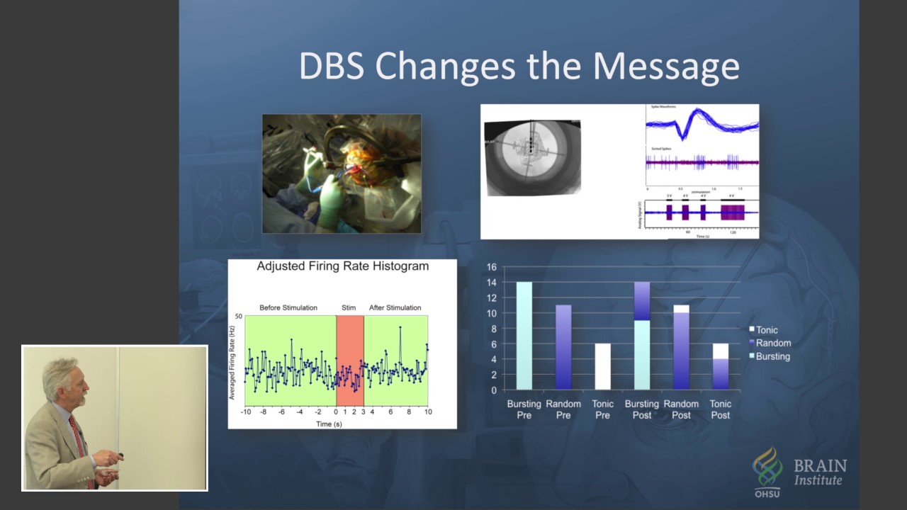 How does DBS work? - YouTube
