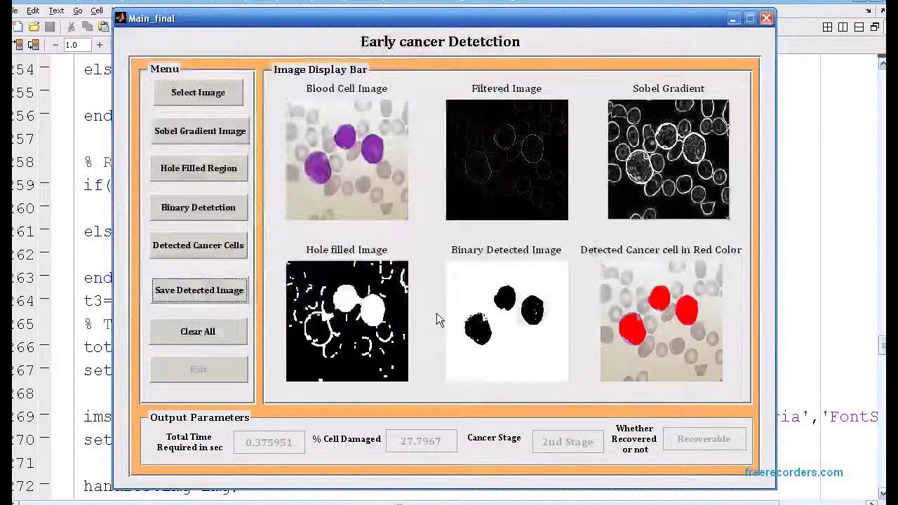 MATLAB code of leukemia Detection || Blood cancer detection - YouTube