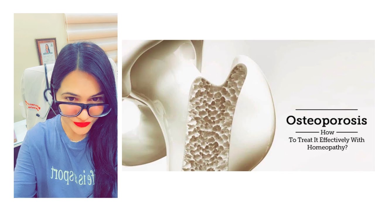 Hollow Bone ? Weak Bone Best Homeopathic Medicine? Osteoporosis ...