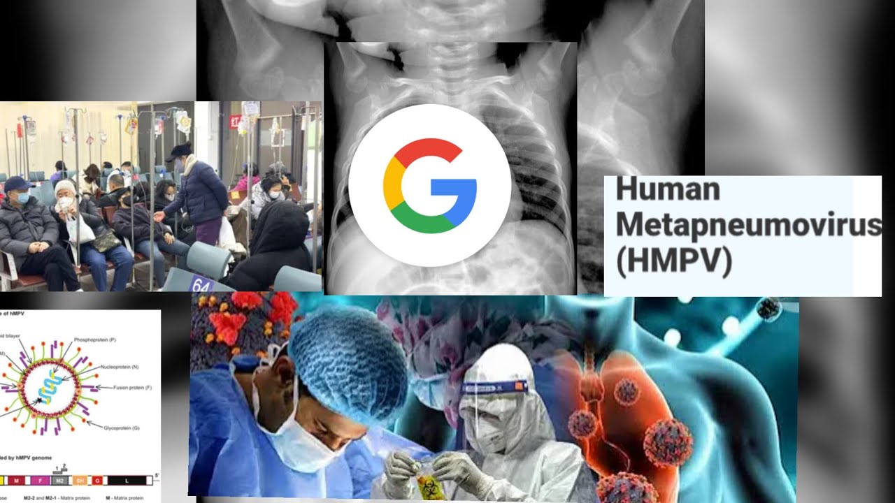 HMPV?TO COVID-19 Guma Murugo Yatangiye Icyorezo gishya - YouTube