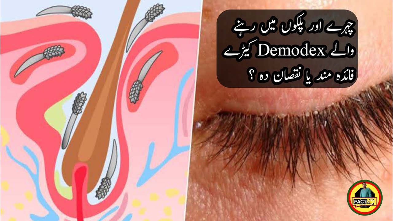 demodex | Fact about demodex - YouTube