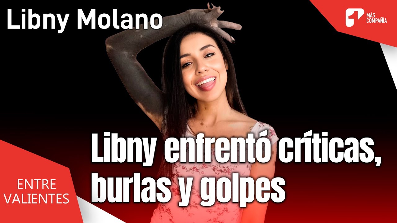 Libny Molano creció sufriendo bullying por su condición: "Una vez me enterraron un lápiz" - YouTube