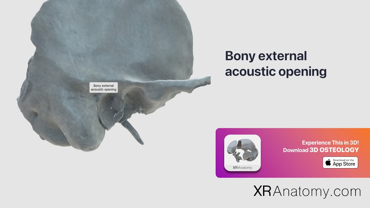 Temporal Bone - Bony external acoustic opening - YouTube
