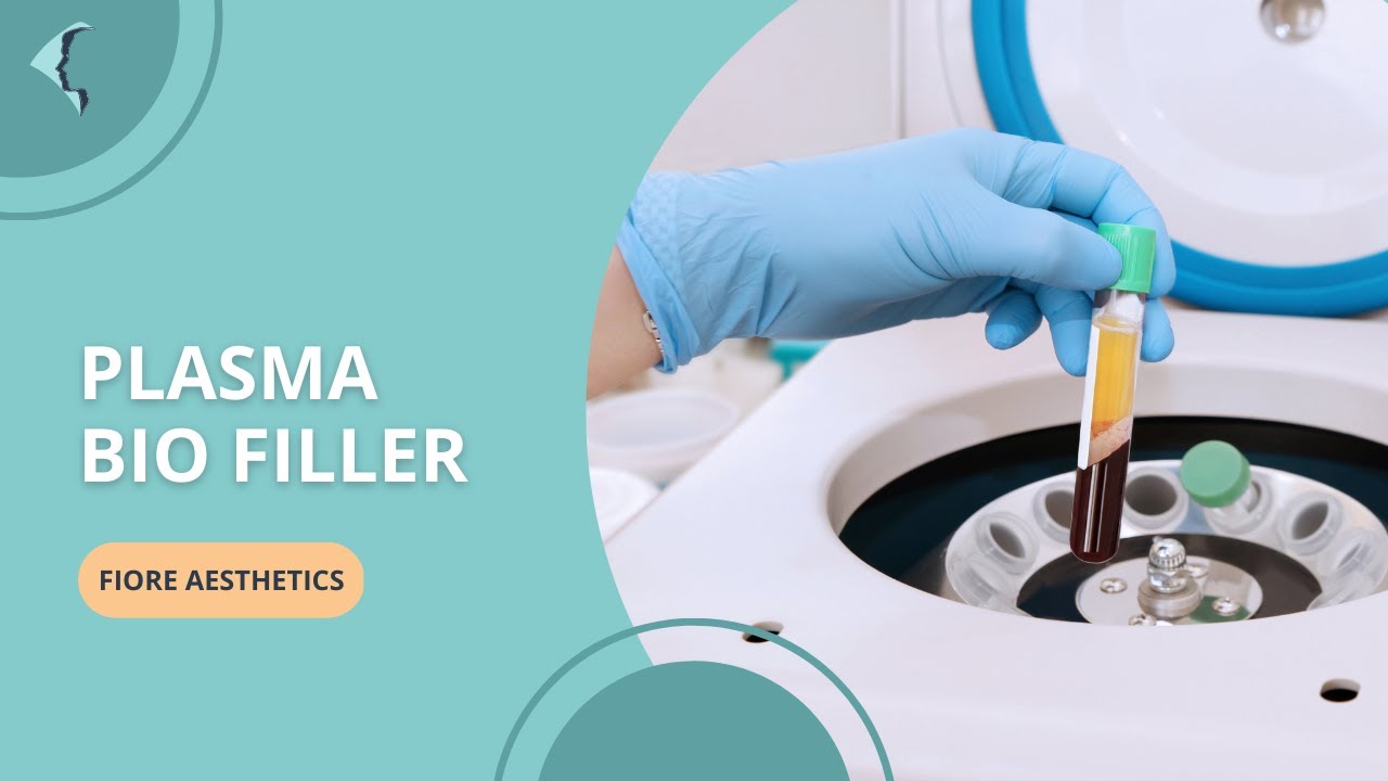 Plasma Bio Filler: Everything You Need to Know - YouTube