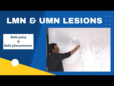 LMN & UMN Lesions Made Easy || How to differentiate LMN & UMN lesions ...