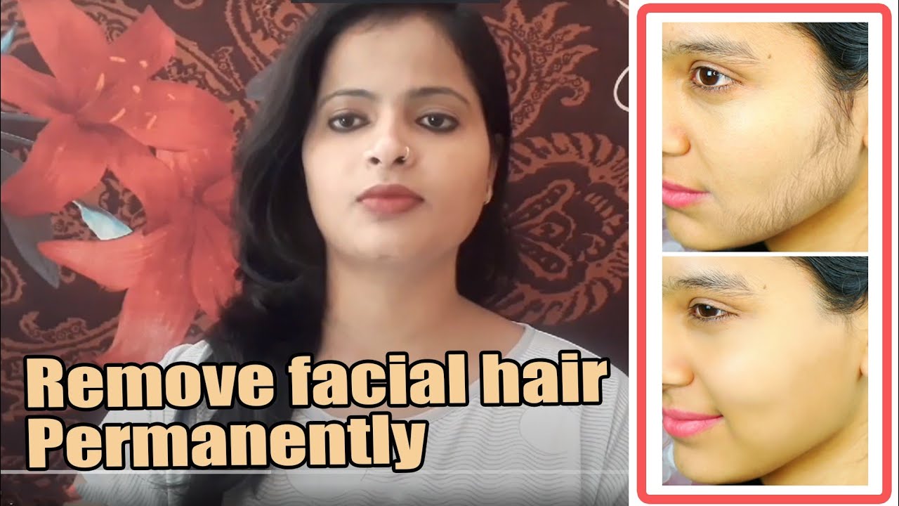 Permanent facial hair removal cream ( Eflora and Elyn ) review. Remove ...