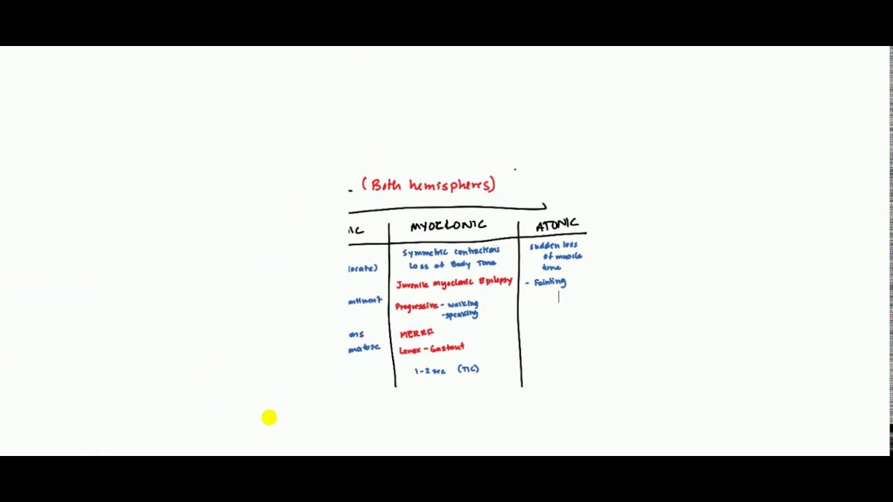 Seizure and Epilepsy for USMLE Step 1 and USMLE Step 2 - YouTube