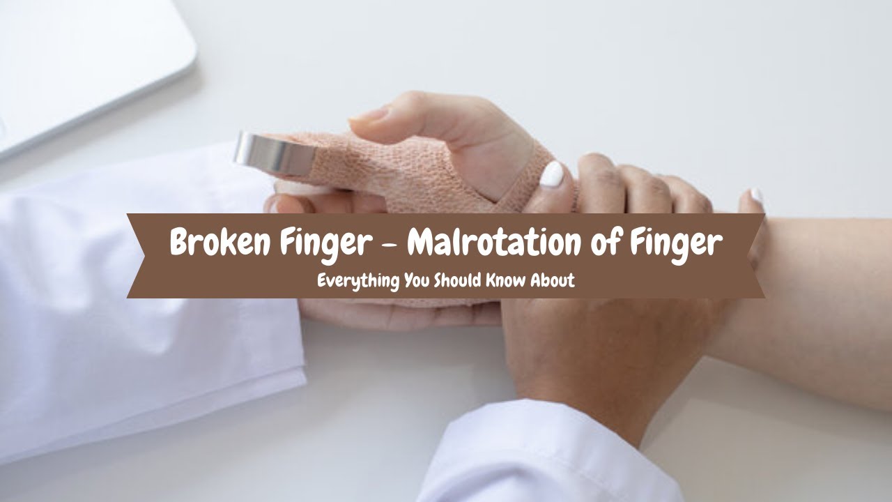 Broken Finger - Malrotation of Finger | Illness Insights - YouTube