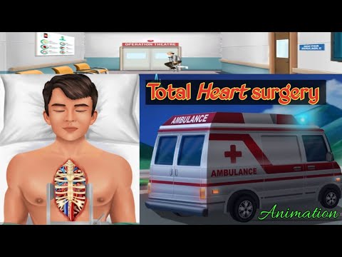 CABG | heart bypass surgery| animation game #surgery #heartsurgery # ...