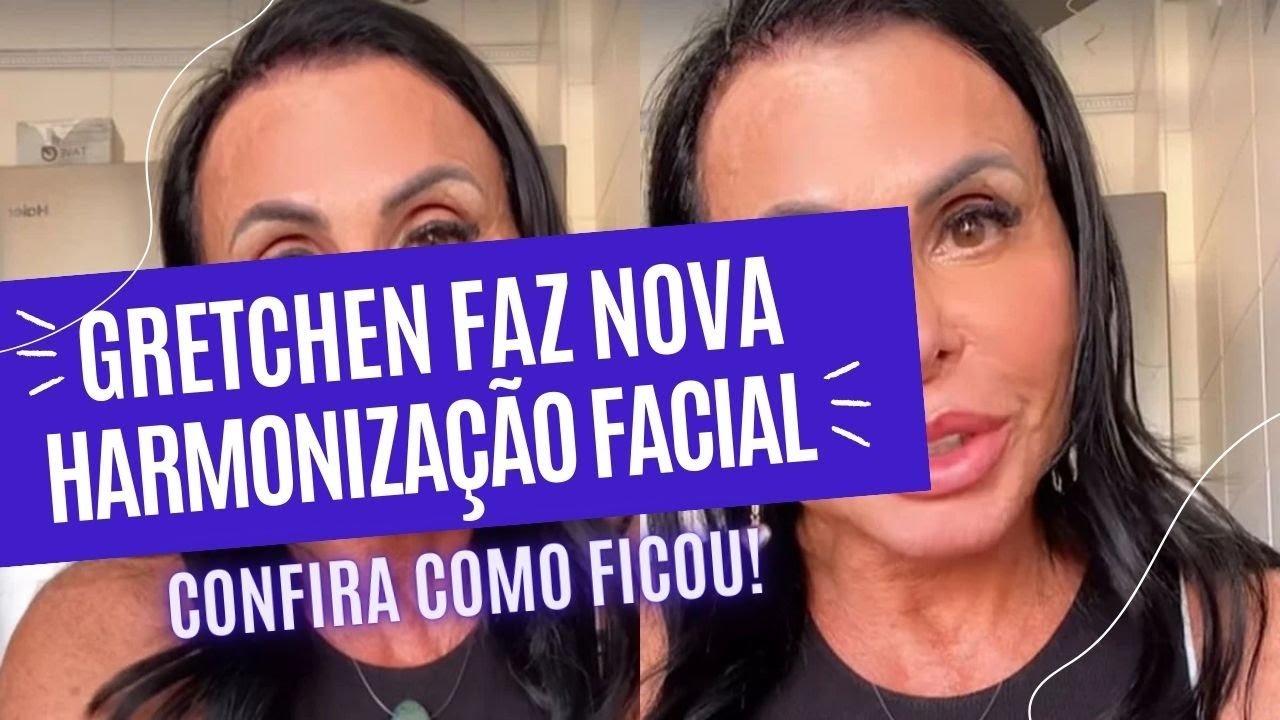 Gretchen faz nova harmonização facial. Ficou linda, confira! - YouTube