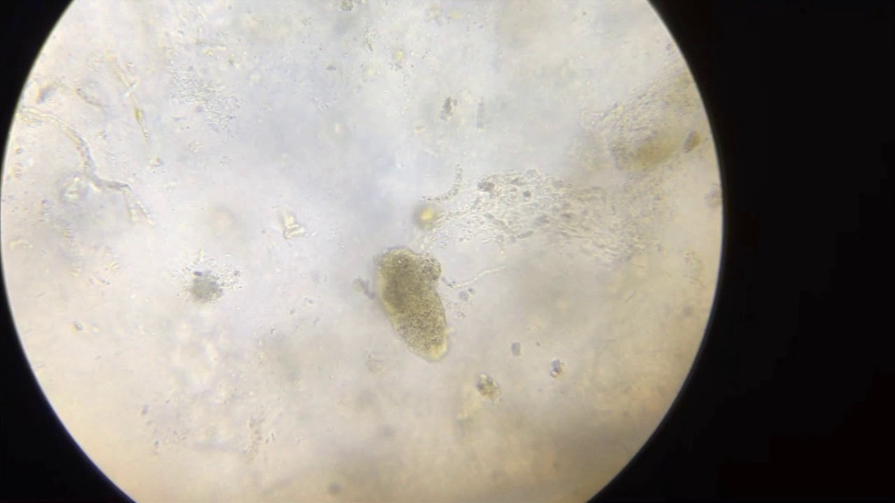 Fish feces under the microscope 400x - YouTube