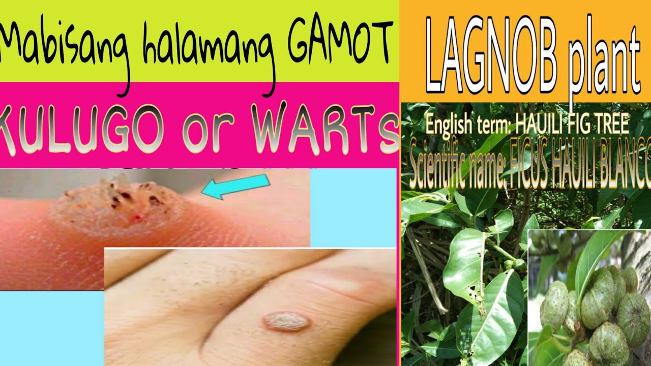 Halamang gamot sa WARTs or KULUGO!!! - YouTube