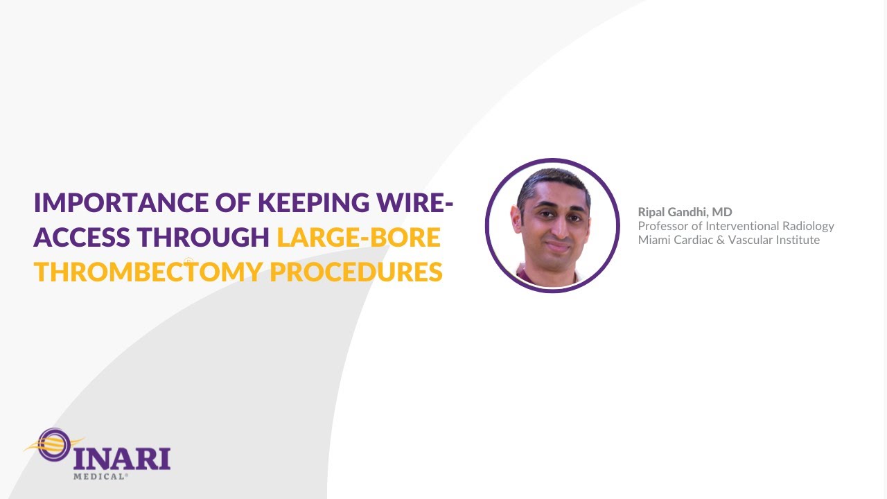 Importance of Keeping Wire Access Through Large Bore Thrombectomy ...
