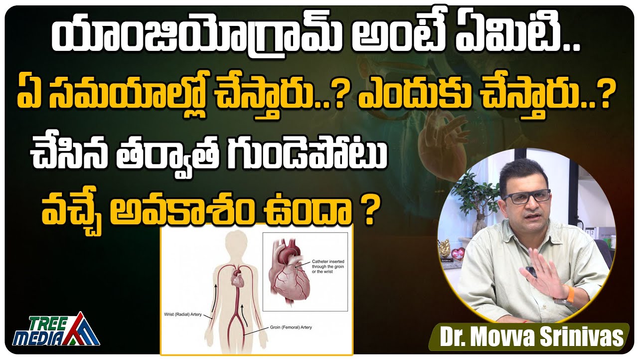 Is it possible to have a heart attack after an Angiogram ? | Dr. Movva ...