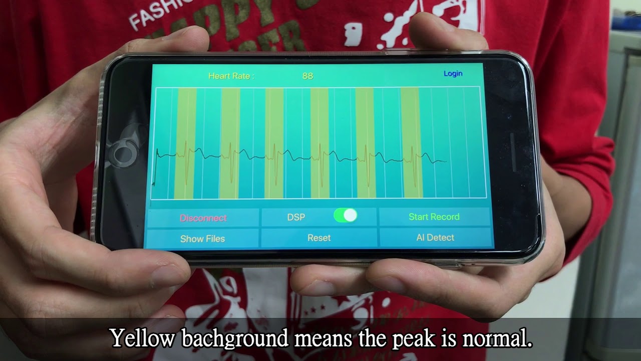 2019 AICAS Live Demo ECG monitor with AI algorithm - YouTube