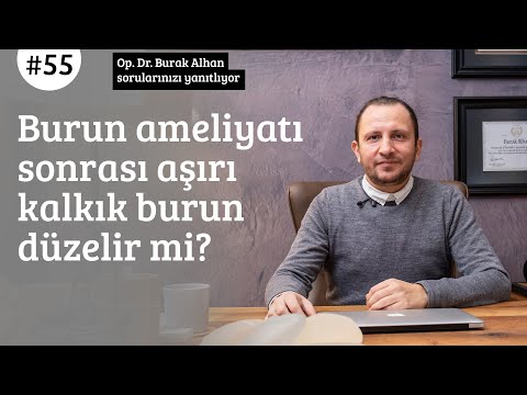 Burun ameliyatı sonra aşırı kalkık burun düzelir mi?
