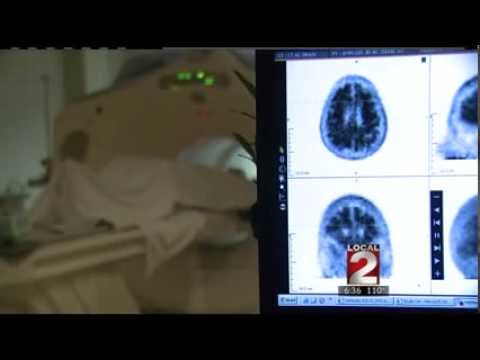 Amyvid PET/CT on KPSP - Dr. Judith Rose - YouTube