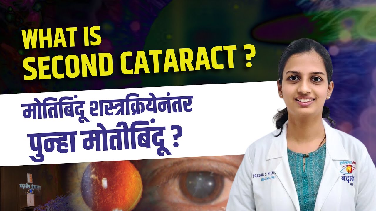 मोतिबिंदू शस्त्रक्रियेनंतर पुन्हा मोतीबिंदू? | What is Secondary ...