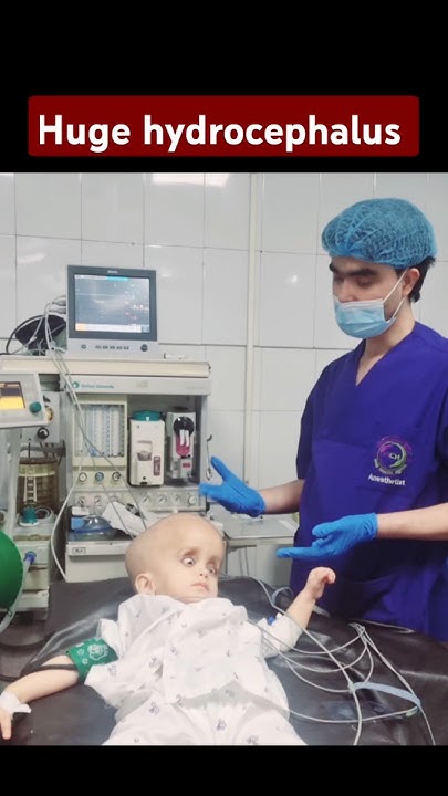 Massive hydrocephalus patients ☠️#shorts #shortvideo #anesthesia - YouTube