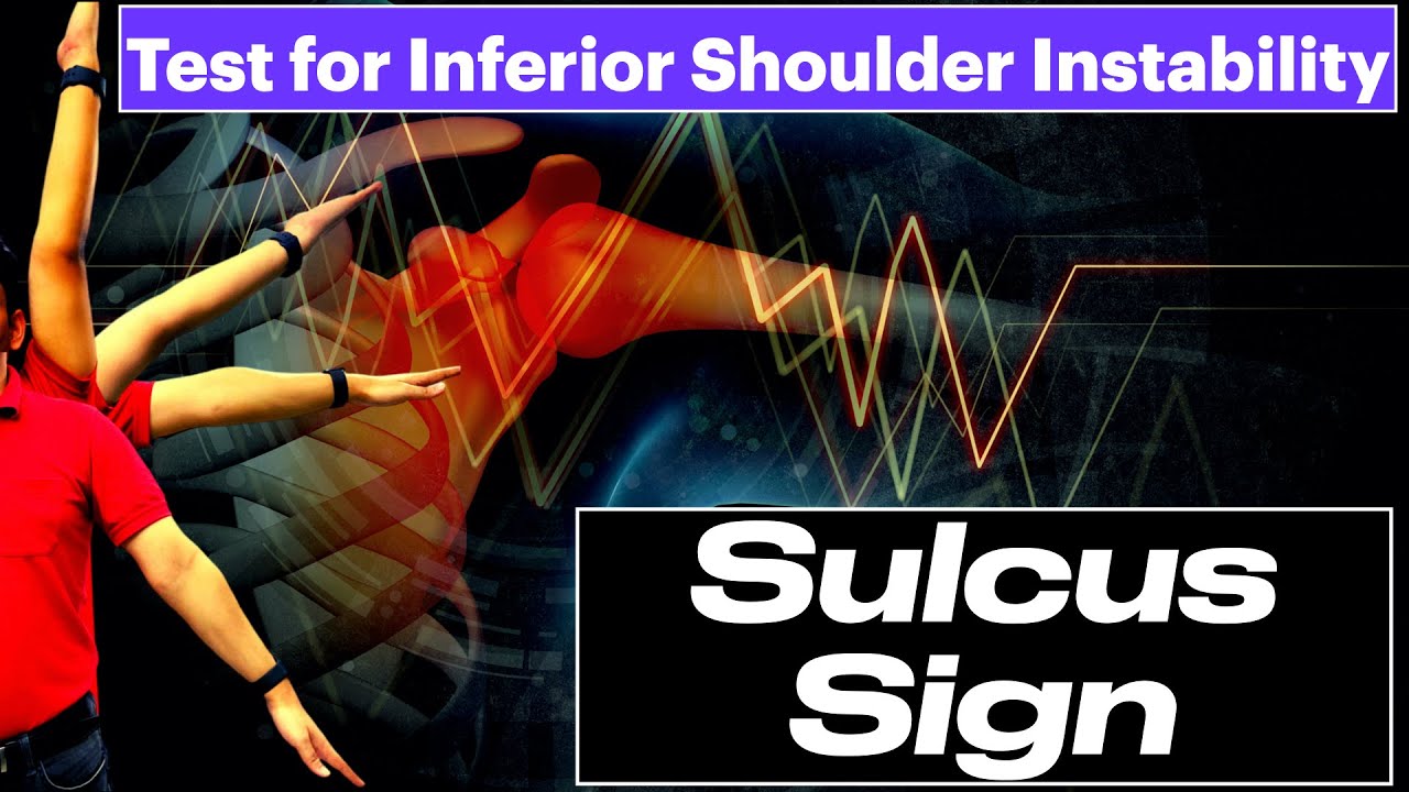 Sulcus Sign | Inferior shoulder instability test. - YouTube