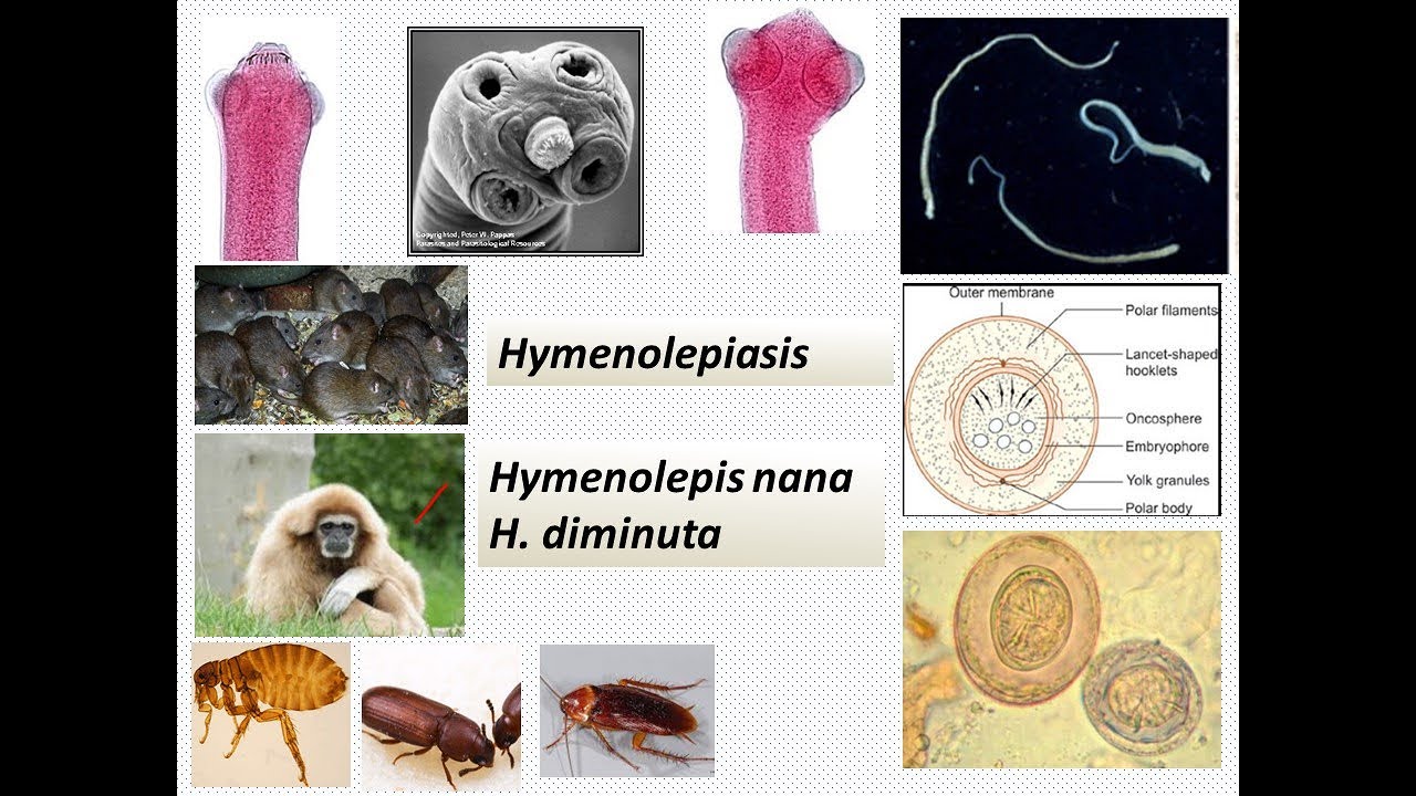 Hymenolepis nana/Hymenolepis diminuta infection or Hymenolepiasis in ...
