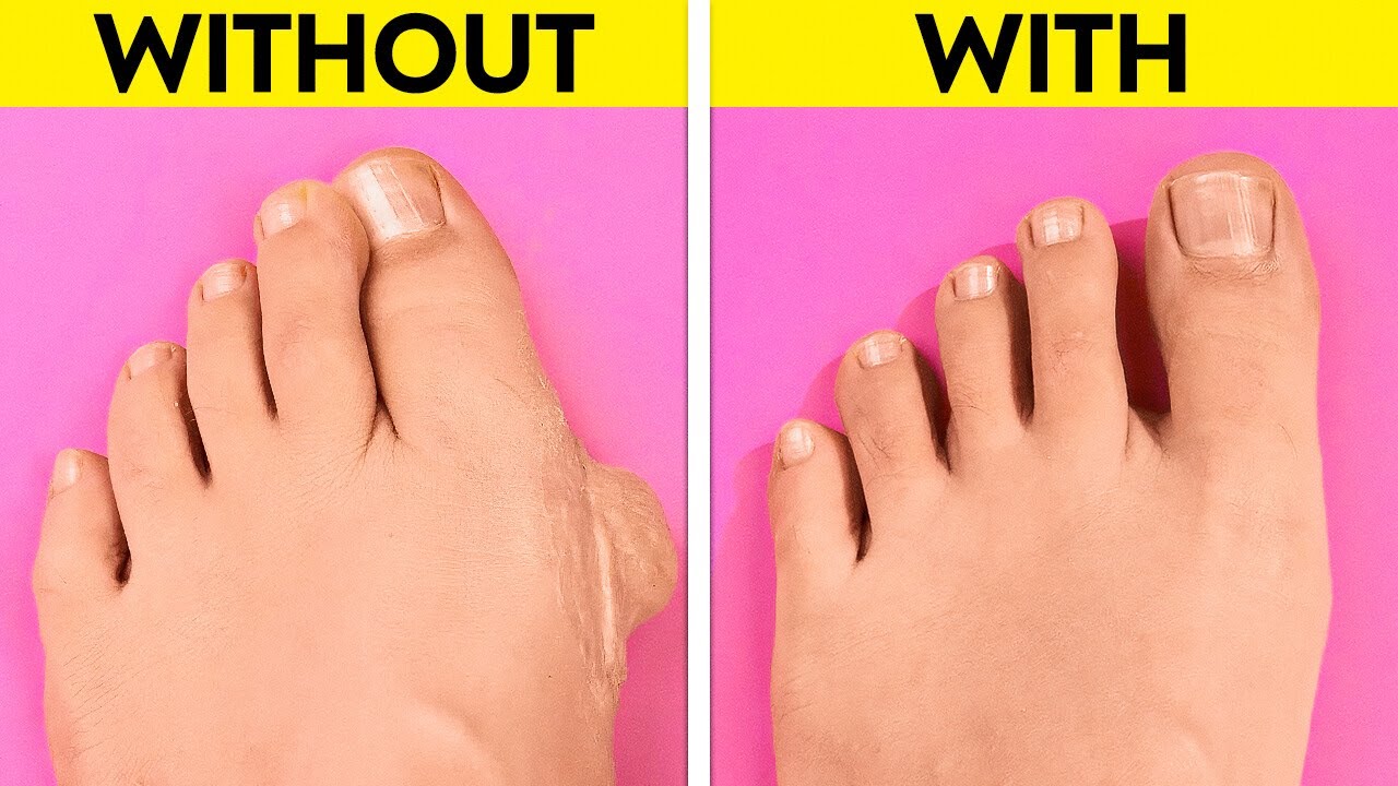 BEST FEET HACKS AND GADGETS THAT WORK SO WELL - YouTube