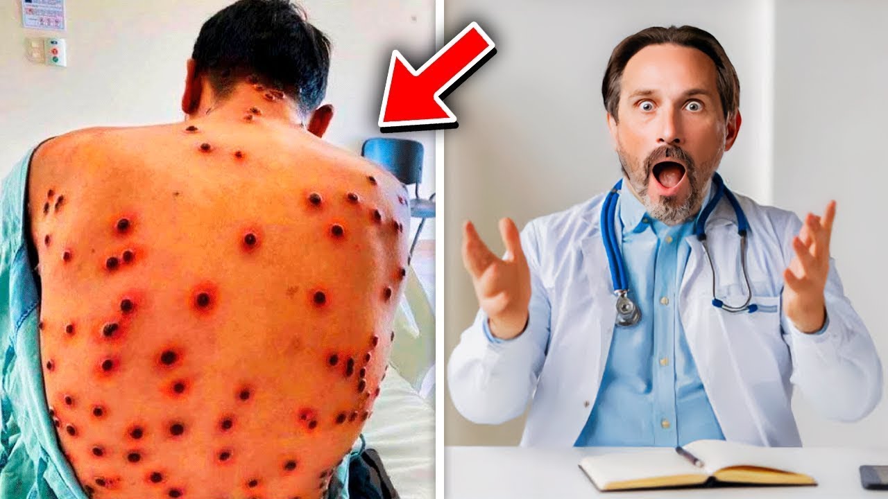This Man Woke Up with Countless Insects Living Inside Him - YouTube