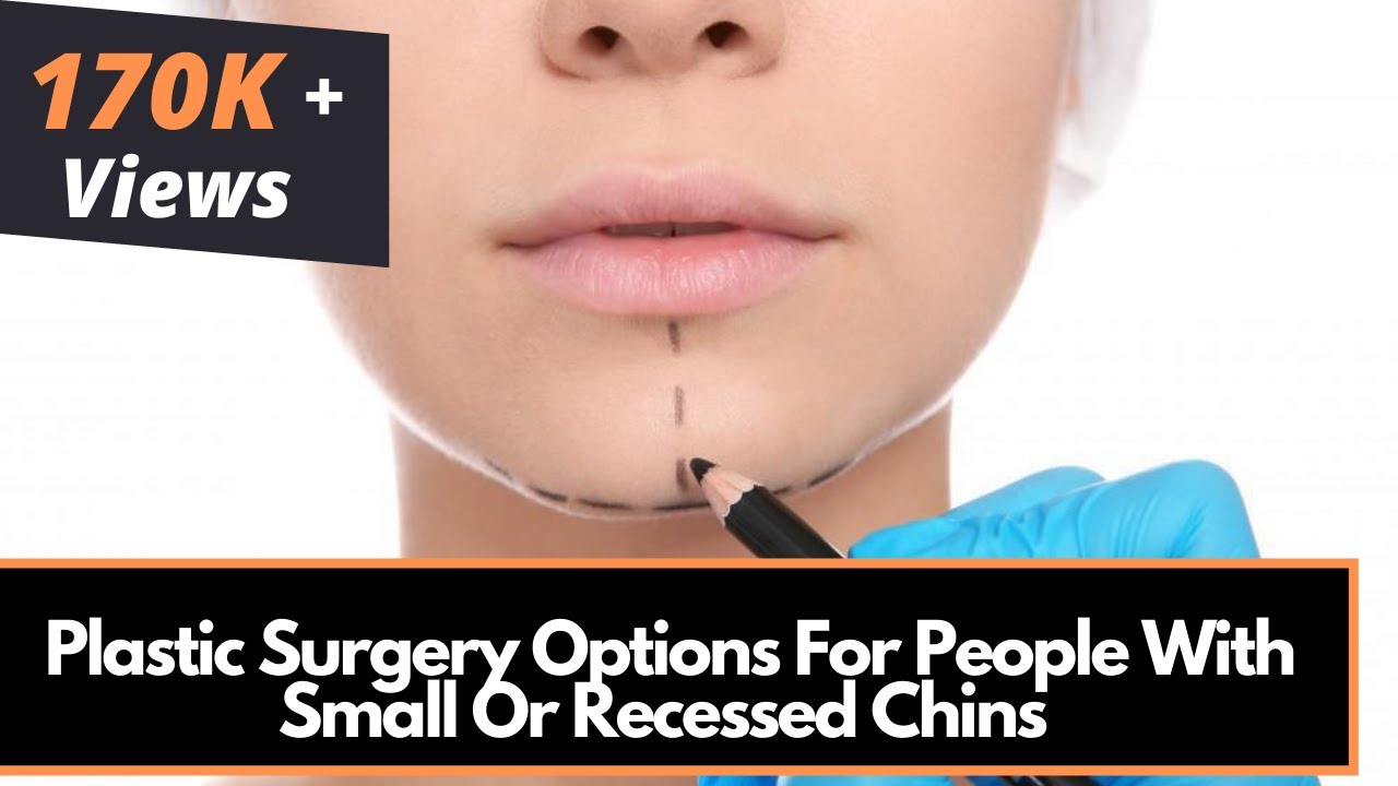 Plastic Surgery Options For People With Small Or Recessed Chins | Dr ...