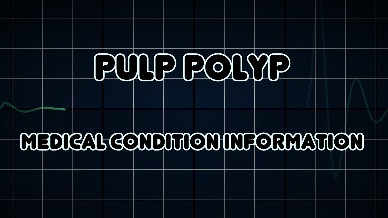 Pulp polyp (Medical Condition) - YouTube