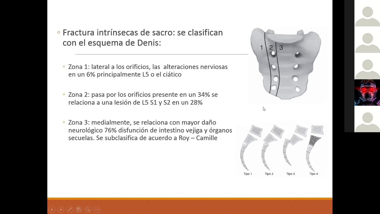 FRACTURAS DE SACRO Y COXIS DR. MARTINEZ TAPIA ADAN R2 - YouTube