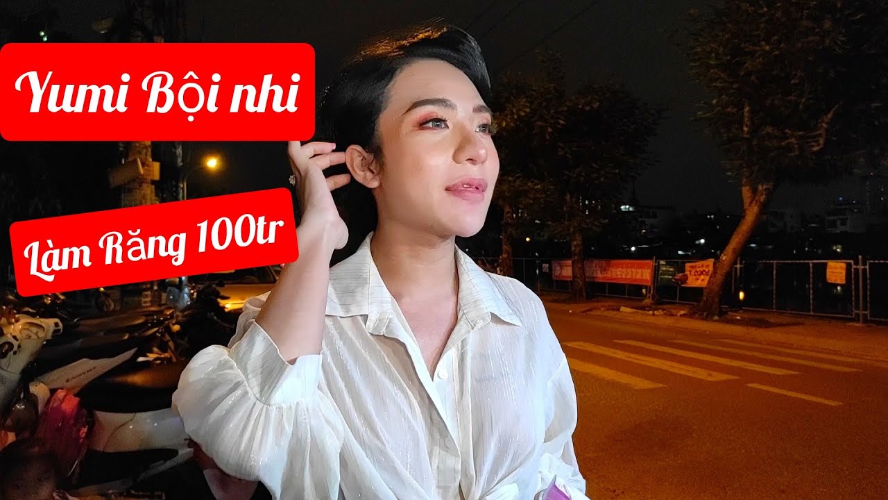 Yumi Bội nhi Trai Đẹp Tại Trợ Làm Răng 100tr Cho Bội nhi - YouTube