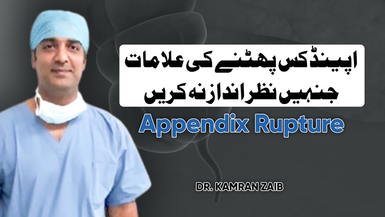 Appendix Rupture Symptoms | Dr. Kamran Zaib Explains Signs & Dangers ...