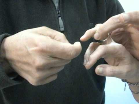 Signo de Hoffmann. - YouTube