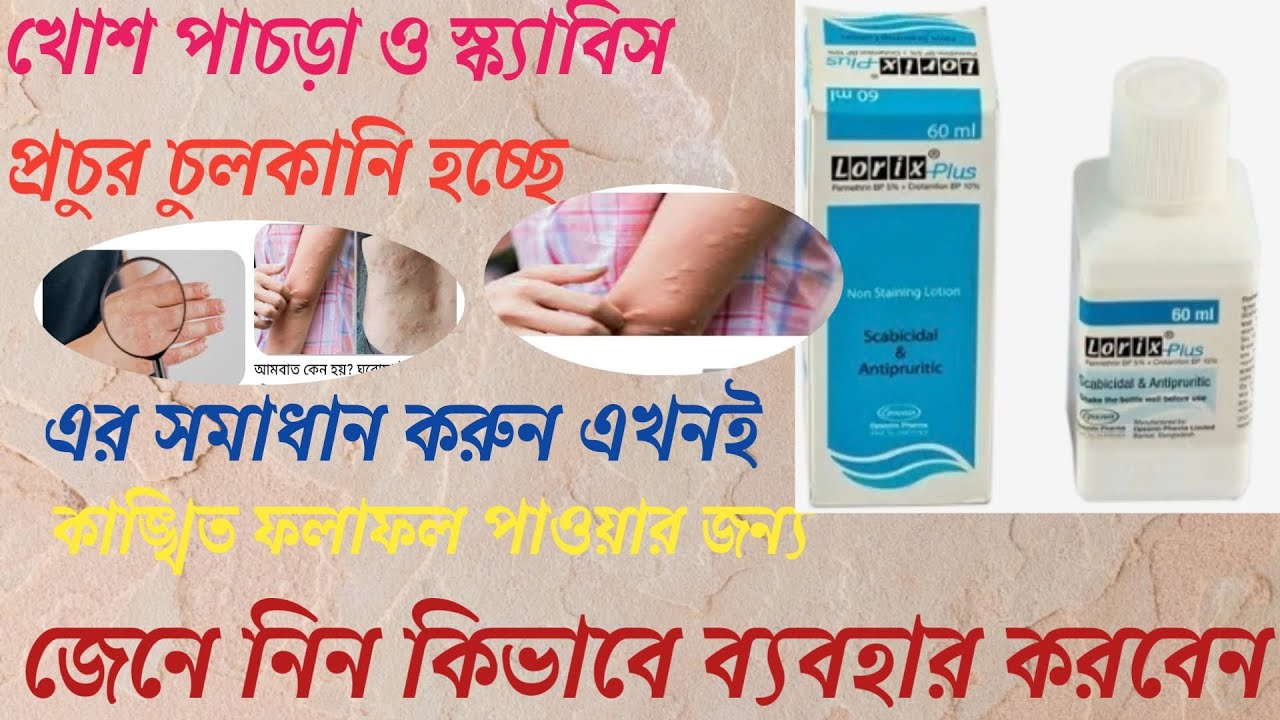 lorix plus ব্যবহারের নিয়ম | খোশ পাঁচড়া ও স্কার্ভিস রোগের চিকিৎসা এই ...