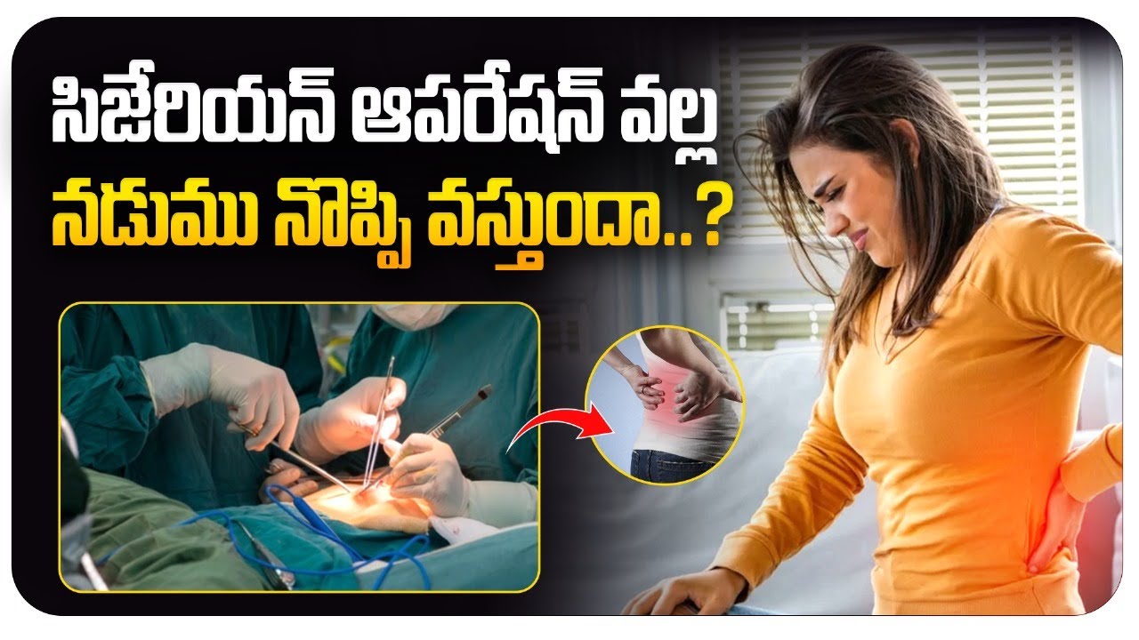 Back Pain After C Section - Reasons and Remedies || Pregnancy ...