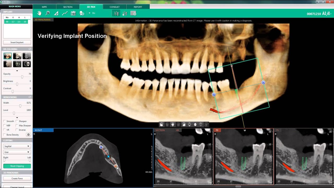 Ez3D i V4 0 - YouTube