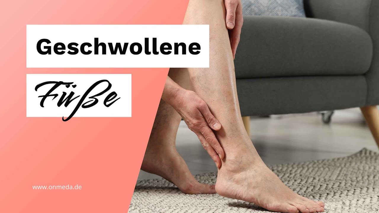 Geschwollene Knchel Einseitig