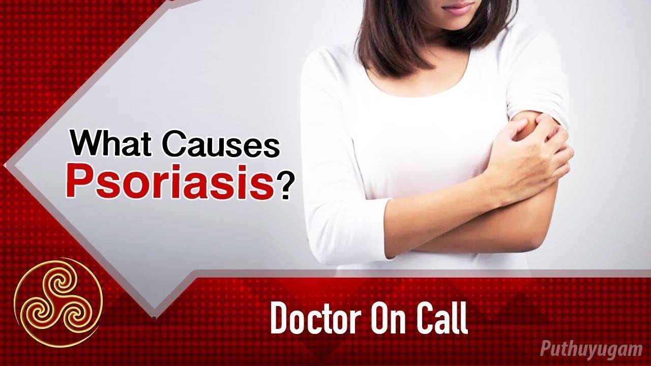 சொரியாசிஸ் வர காரணம் என்ன ? | What causes psoriasis? | Doctor On Call ...