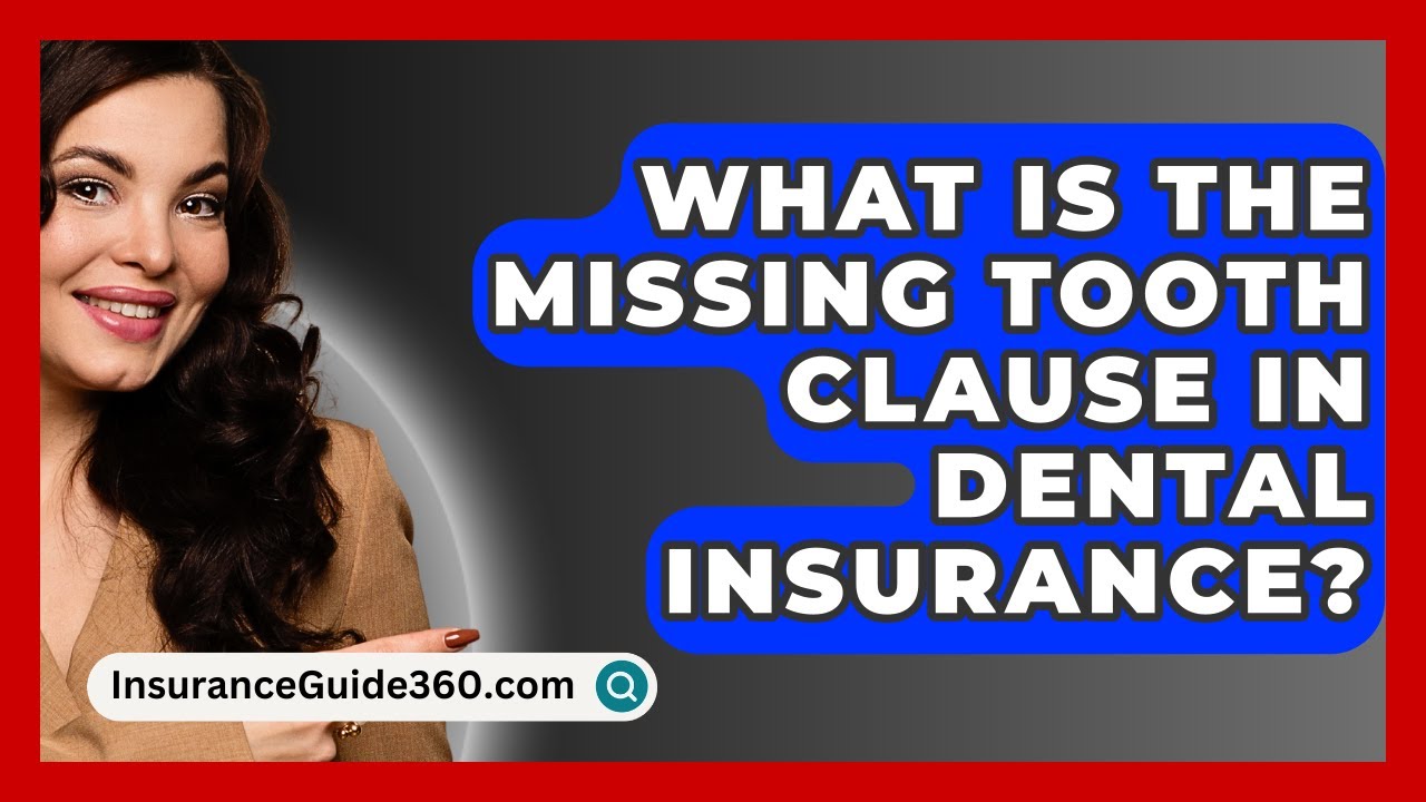 What Is The Missing Tooth Clause In Dental Insurance ...