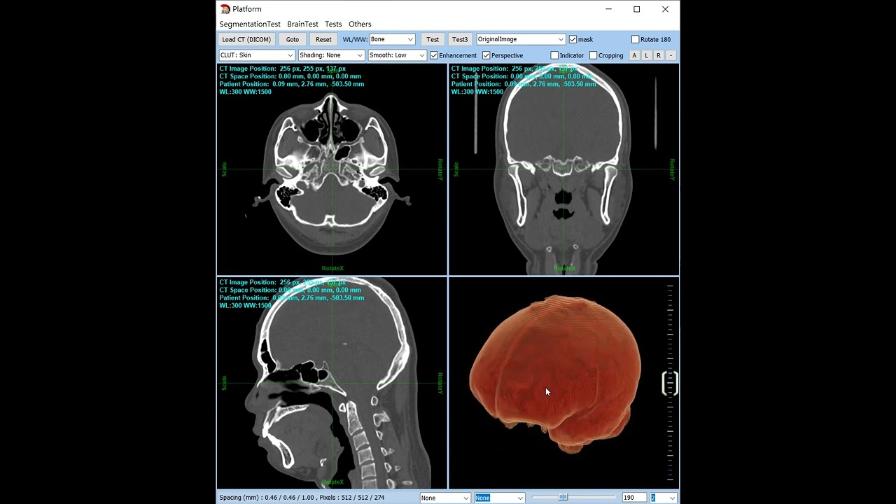 Segmentation for CT Brain - YouTube