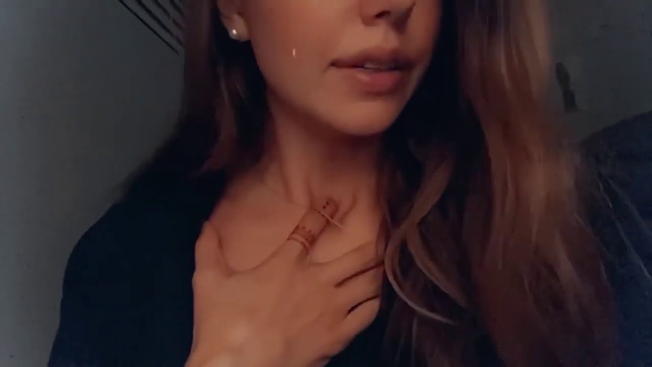 Labored Breathing w/ Suprasternal Retractions and Accessory Muscle Use ...