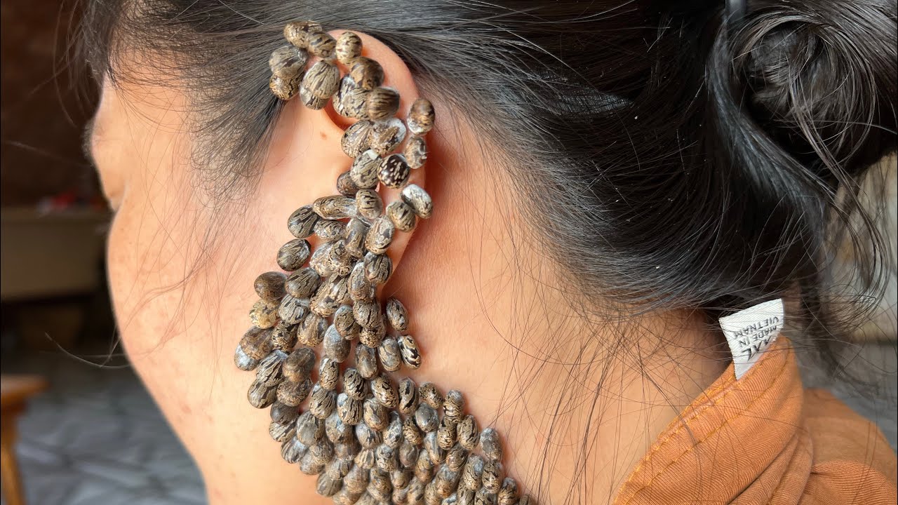 ticks proliferate on the ears and neck#027 - YouTube