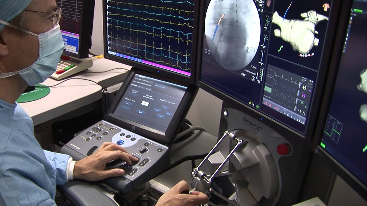 Robotic atrial fibrillation ablation with Hansen system - YouTube