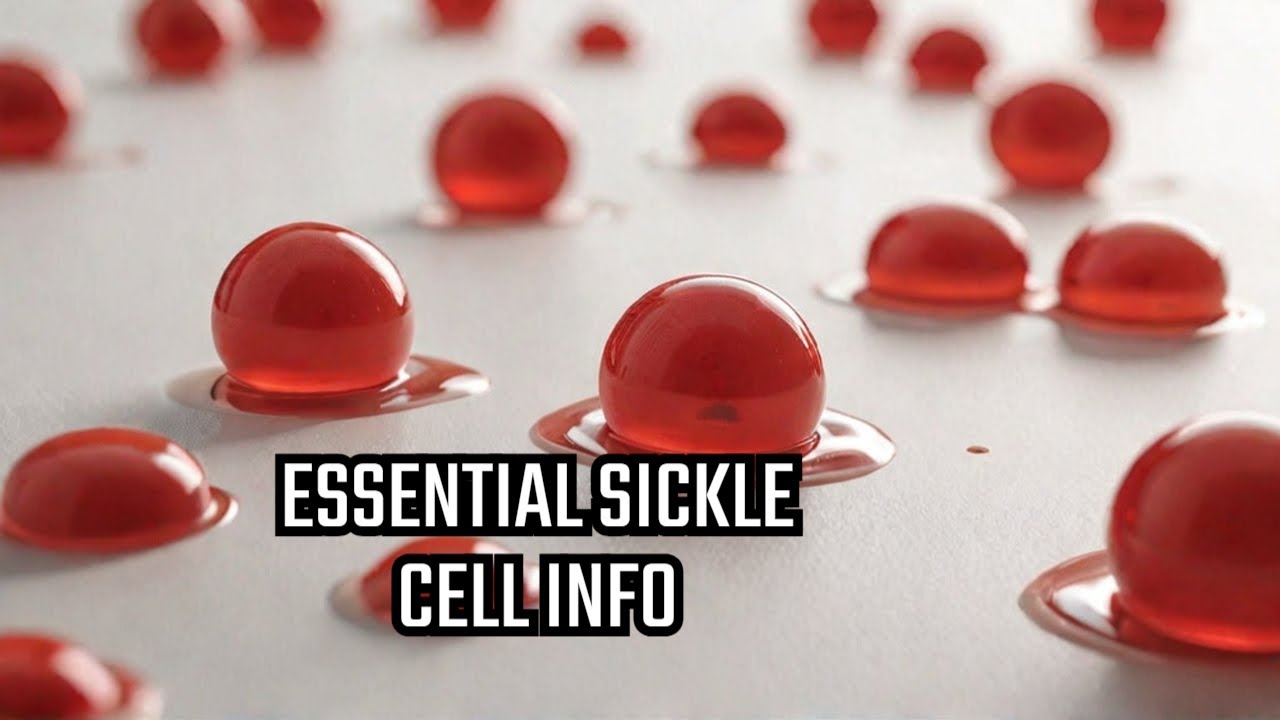 5 Essential Sickle Cell Disease Facts You Need to Know! - YouTube