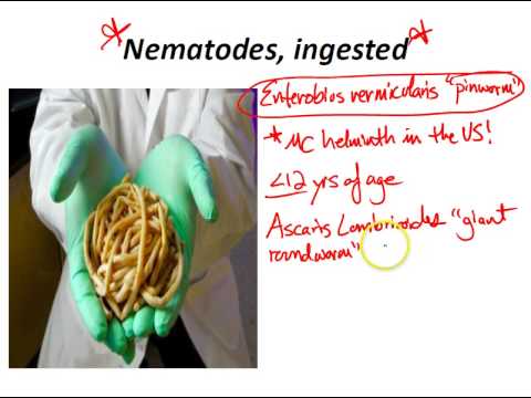 USMLE Review - Micro (Parasites) - YouTube