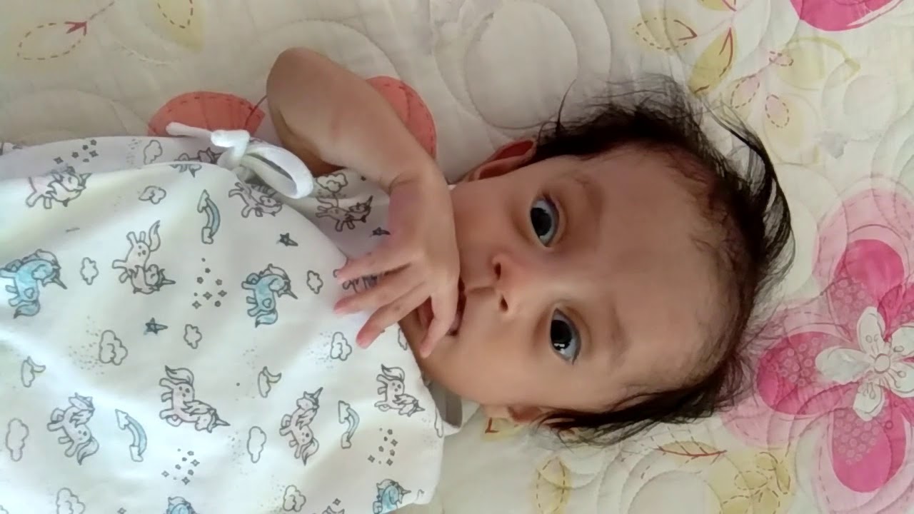 My Baby with rare bone disease-Osteogenesis Imperfecta - YouTube