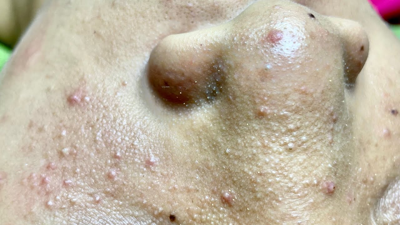 Satisfying video with Chung Vo Spa | 357 - YouTube