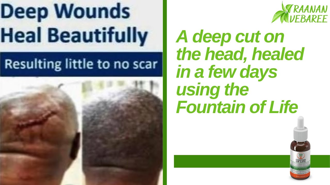 A deep cut on the head, healed in a few days using the Fountain of Life ...