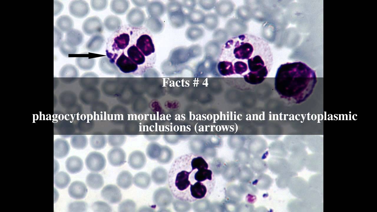 Anaplasma phagocytophilum Top # 6 Facts - YouTube